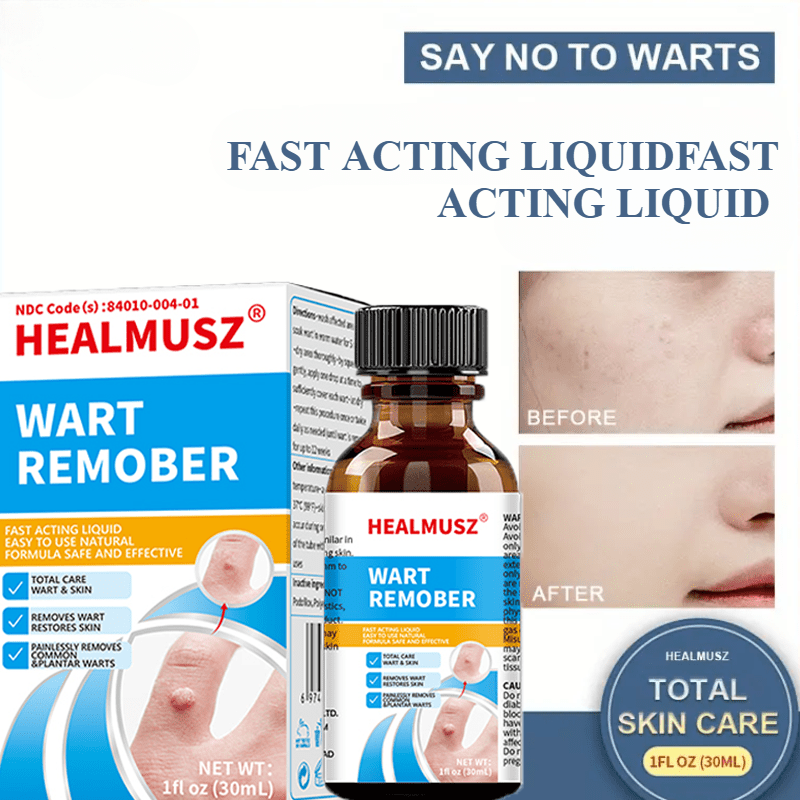 Wart Remover Common Warts Flat Warts Wart Removal Solution - Temu