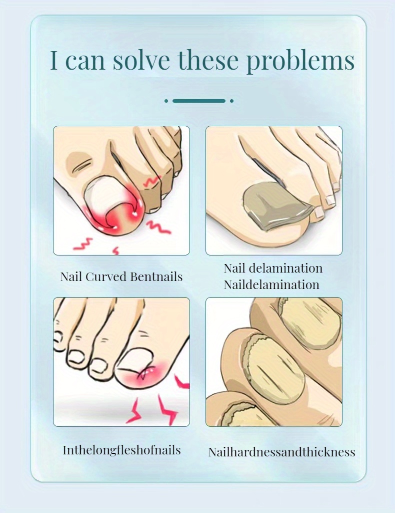 Mermaid Shaped Stainless Steel Beak Nail - Temu Norway