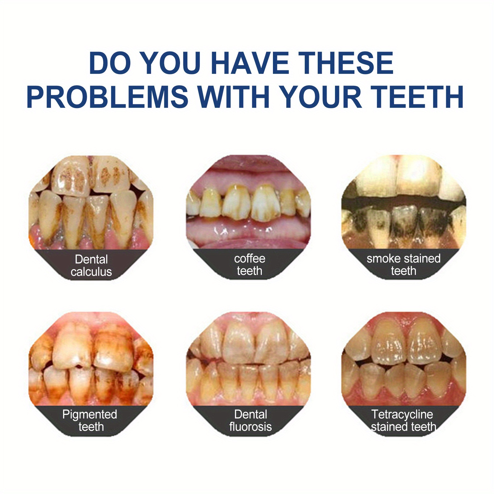 Jaysuing Tooth Paint Whitening Stain Removal - Temu Saudi