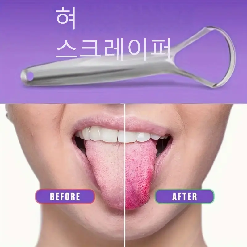 주석 상자가있는 스테인레스 스틸 혀 스크레이퍼 성인용 구취 혀 스크레이퍼 감소 100 금속 Temu