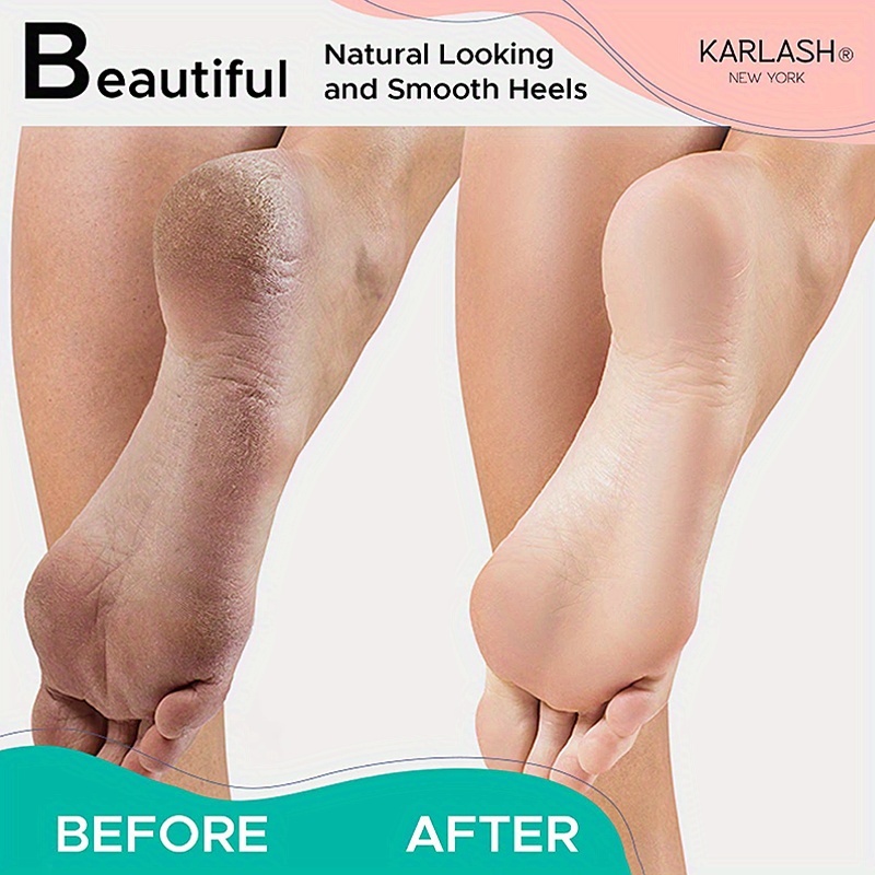 Premium Foot Pumice Stone Callus Removal Dead Skin - Temu United Kingdom