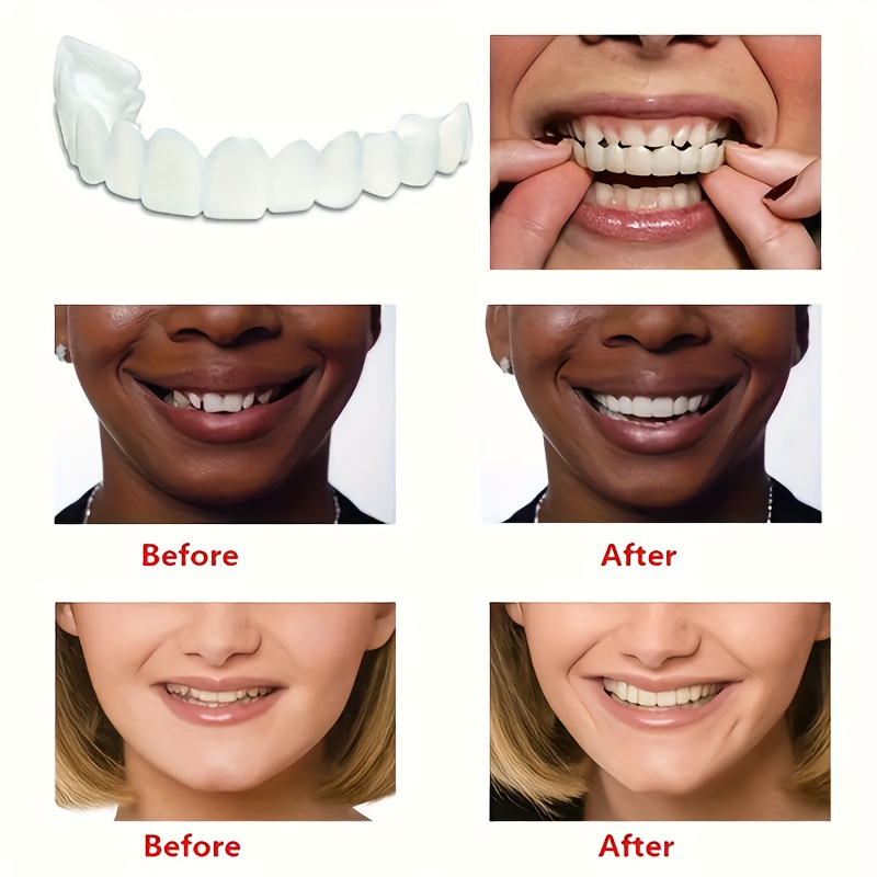 Perfect Smile Veneers Cosmetic Teeth Covers Men Women - Temu Canada