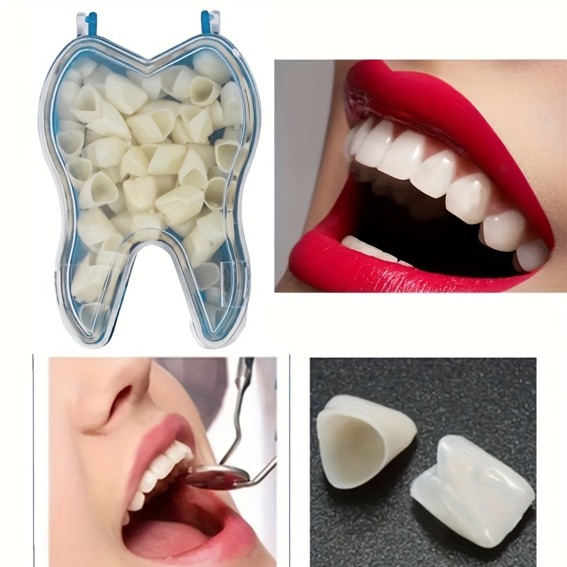 Temporary Dental Crown Veneers Kit Molar Posterior Teeth - Temu New Zealand