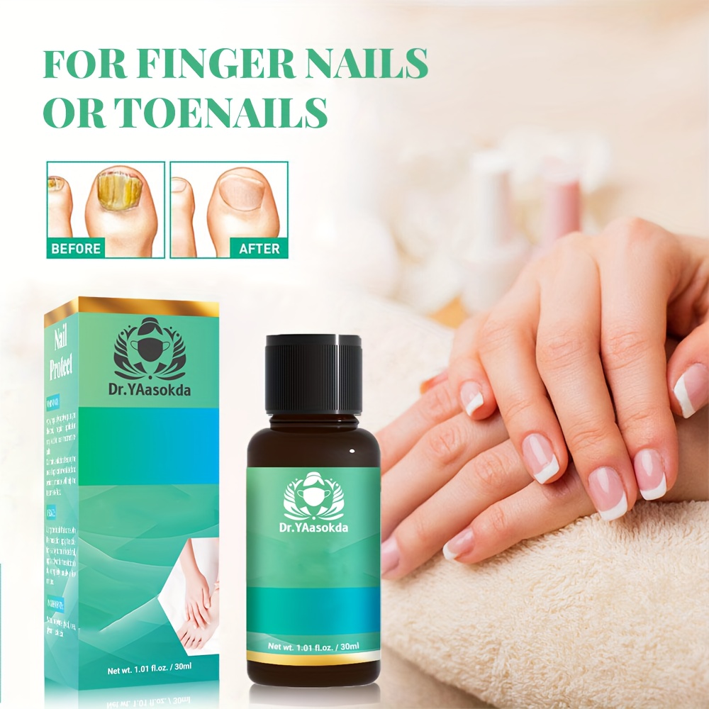 Peeling Nails Cause What this means What to do
