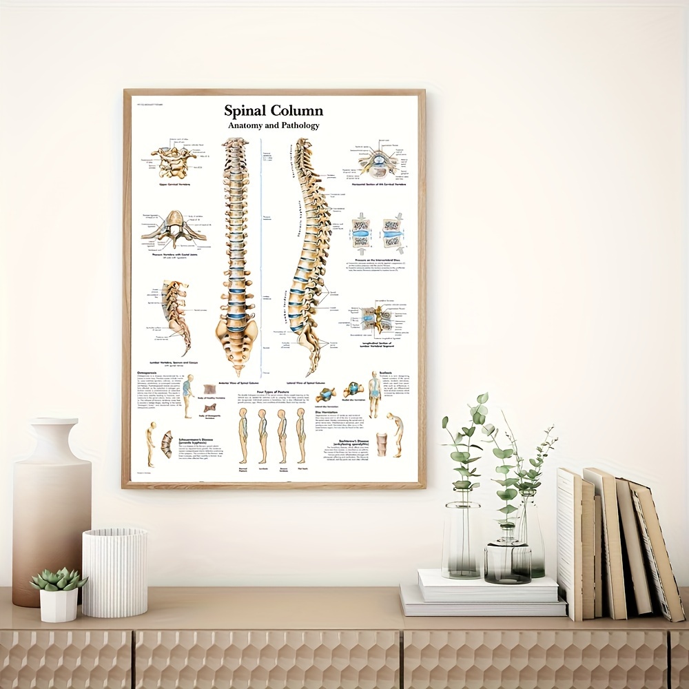 Spinal Column Anatomy And Pathology Poster - Unframed Canvas Print For ...