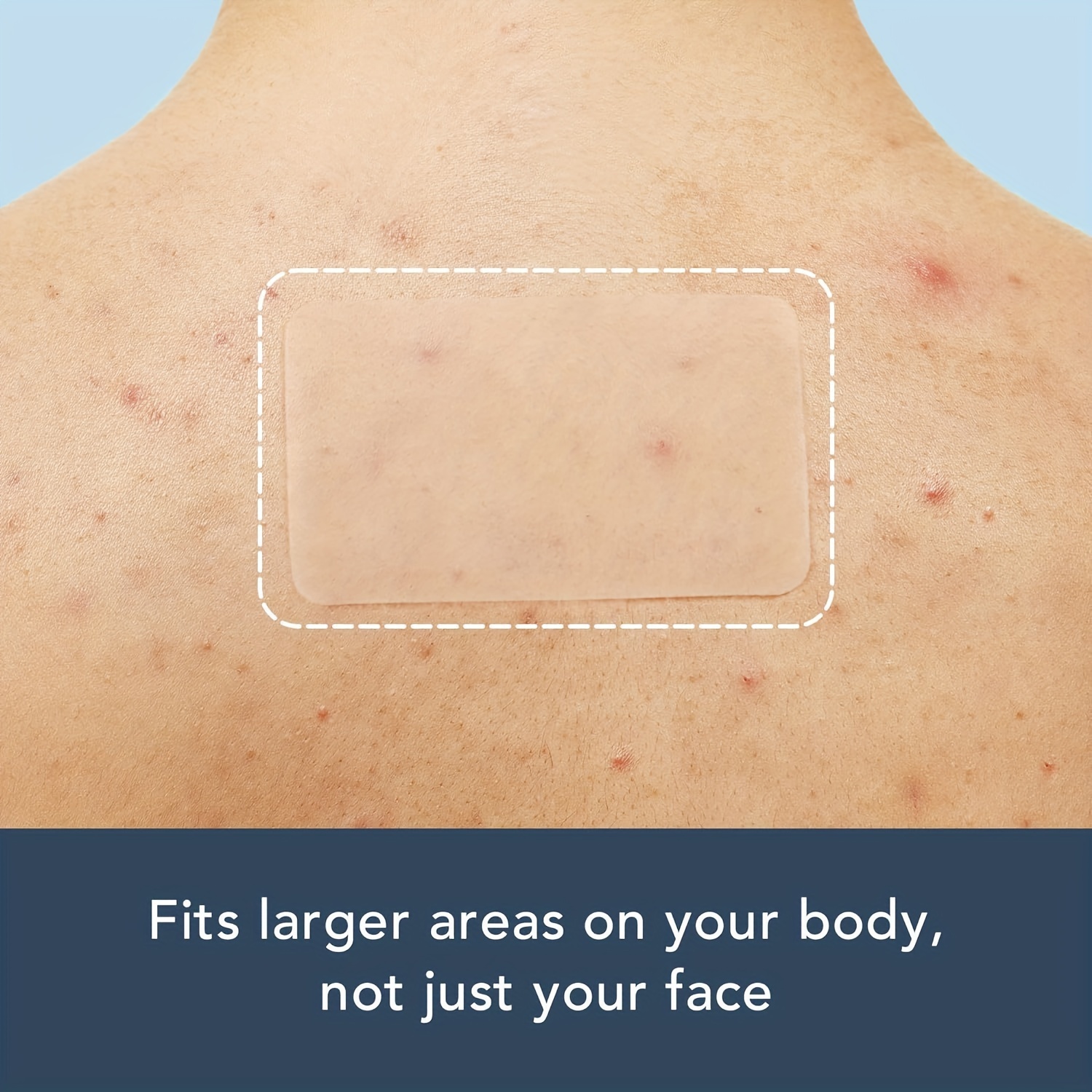 18 Count Extra Large Hydrocolloid Acne Patch, Facial Skin Covering ...