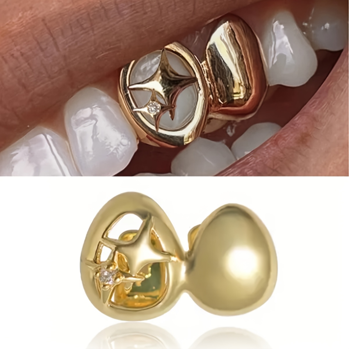 fashion braces for teeth - South Africa