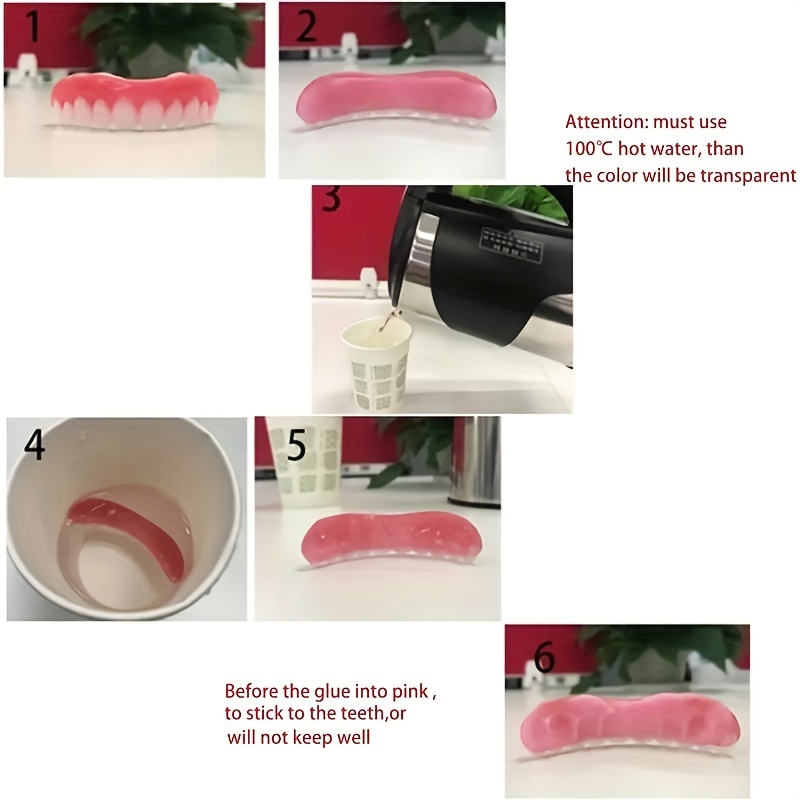 Classic Style Temporary Denture Veneer Set: Eva Material, False Upper ...