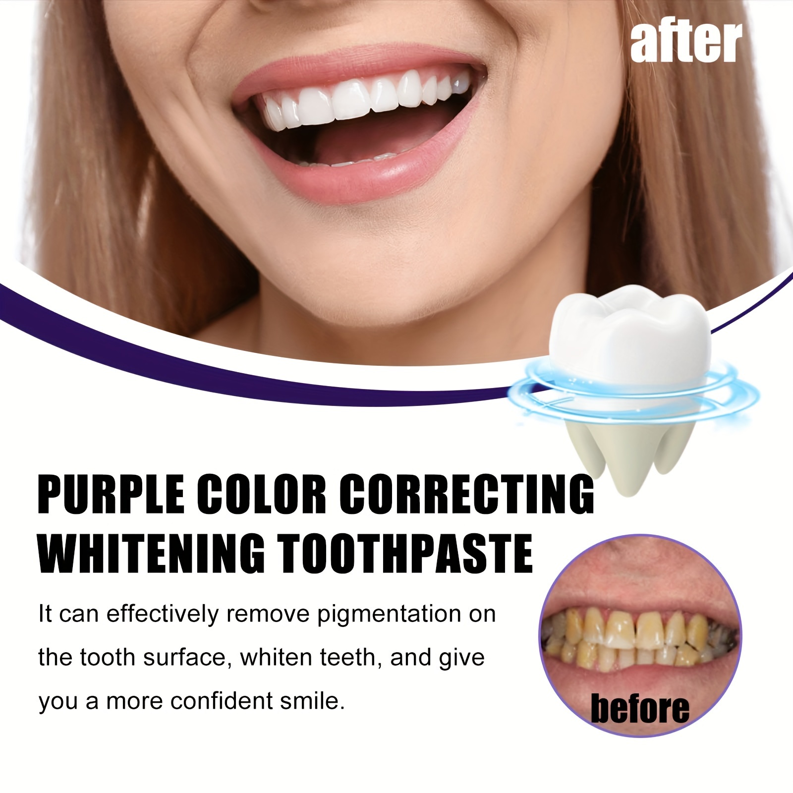 Oralhoe Purple Whitening Toothpaste Formula - Temu
