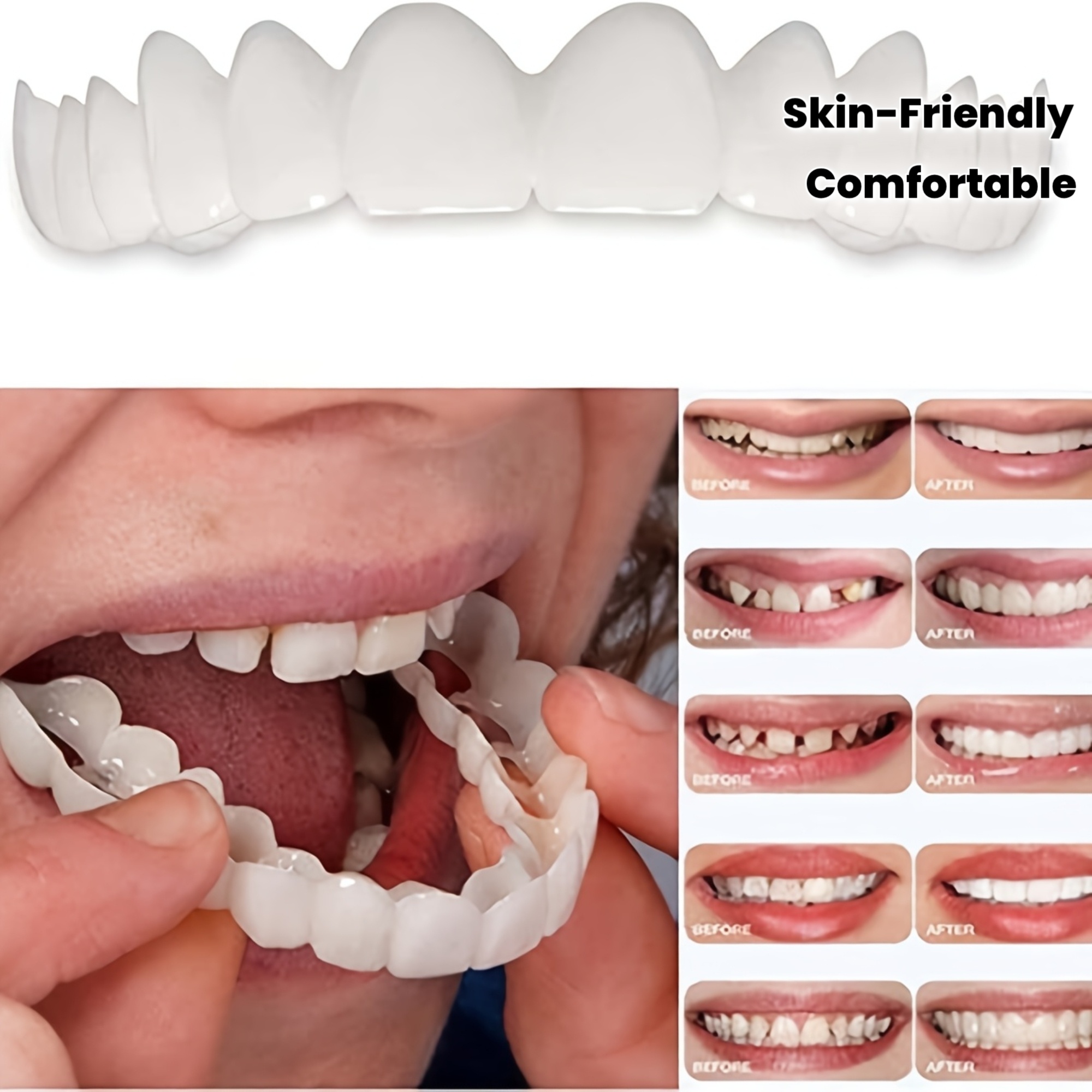 fashion braces for teeth - South Africa