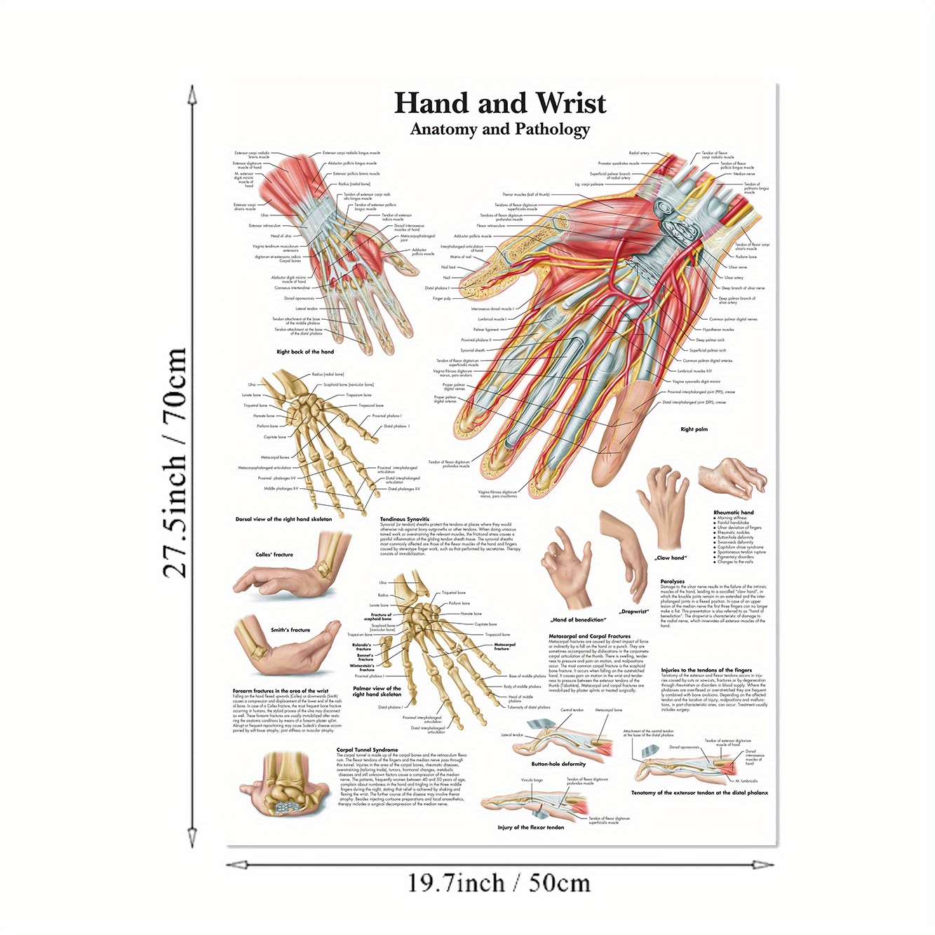 1pc Unframed Canvas Poster, Anatomical Charts Posters, Shoulder And ...