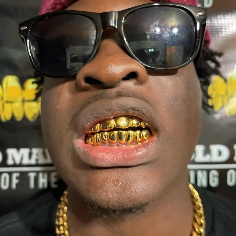 18k Gold Plated Hip Hop Grills Cool Handsome Style Synthetic - Temu ...