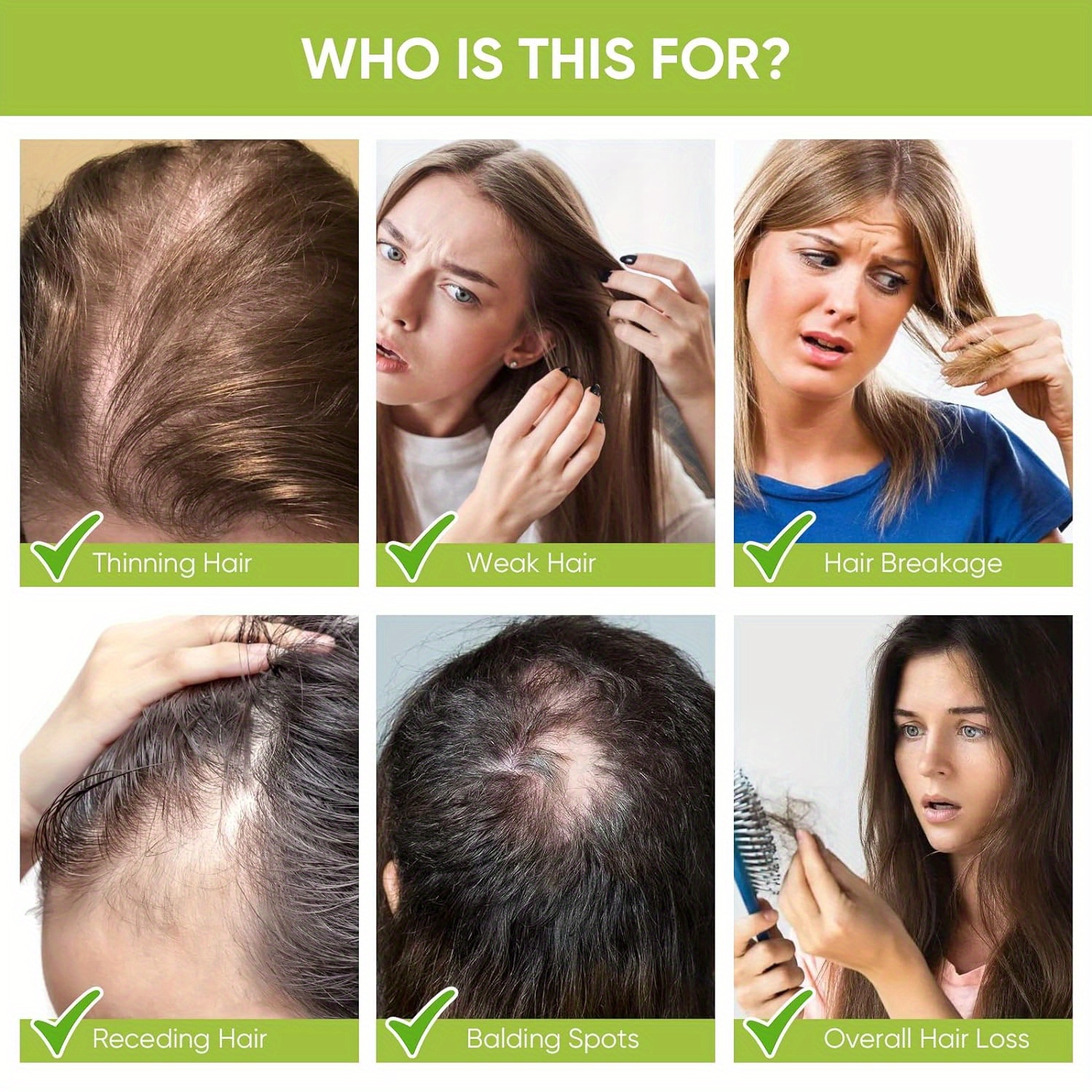 5% Minoxidil Hair Growth Cream Kit Men Women Stop Hair Loss - Temu