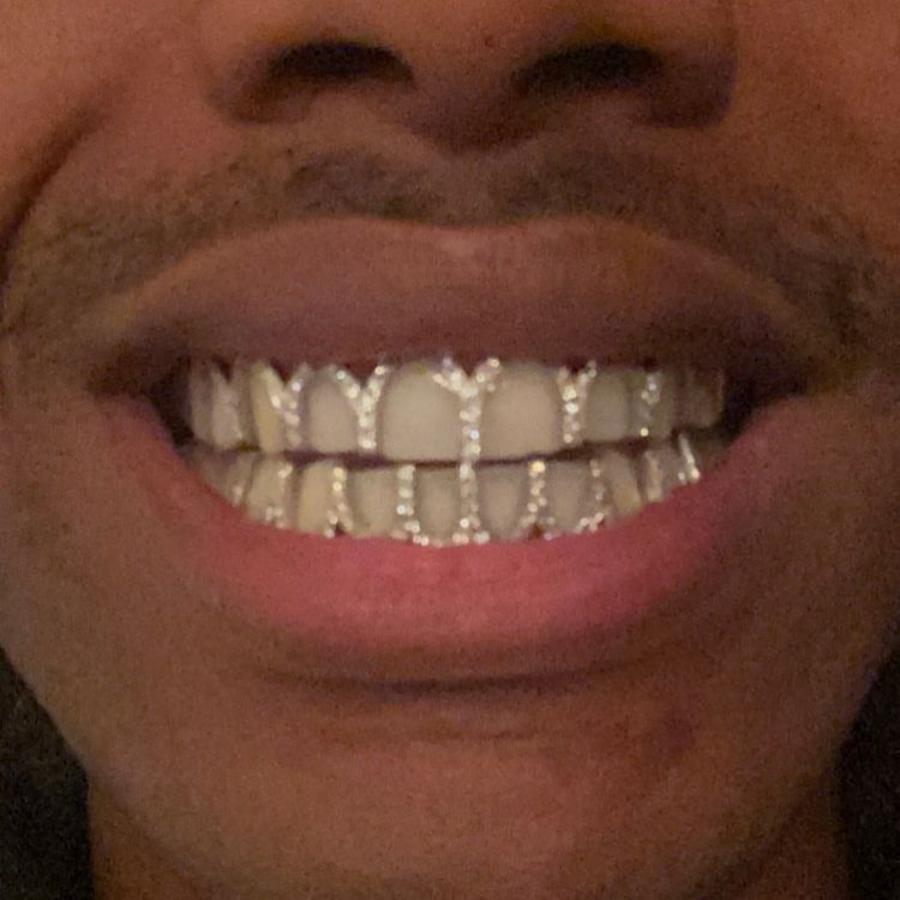 teeth grills sold on Temu United States